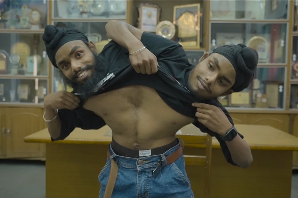 Irmãos siameses indianos têm duas identidades mas recebem um só salário ...
